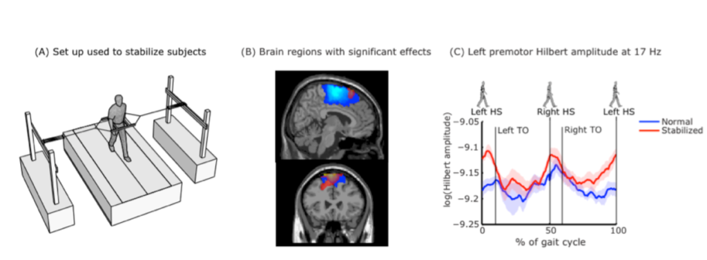 Do you need your brain to walk? - ISPGR